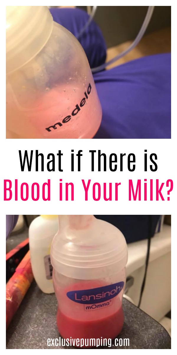 Cracked and Bleeding Nipples when Pumping Breast Milk