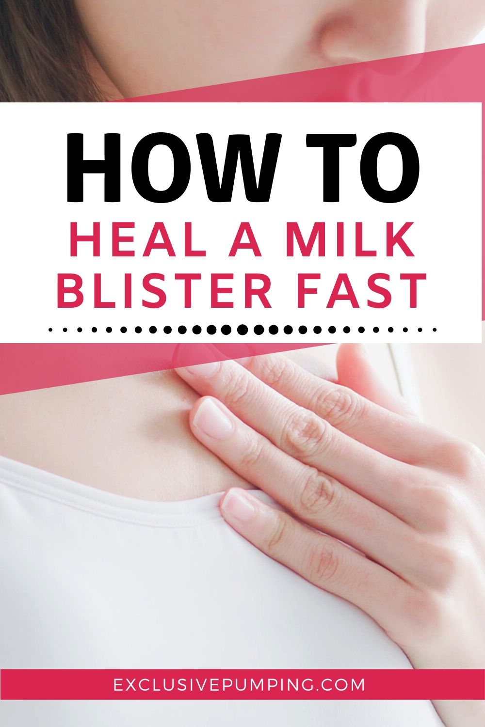 How to Treat a Milk Blister When You're Exclusively Pumping