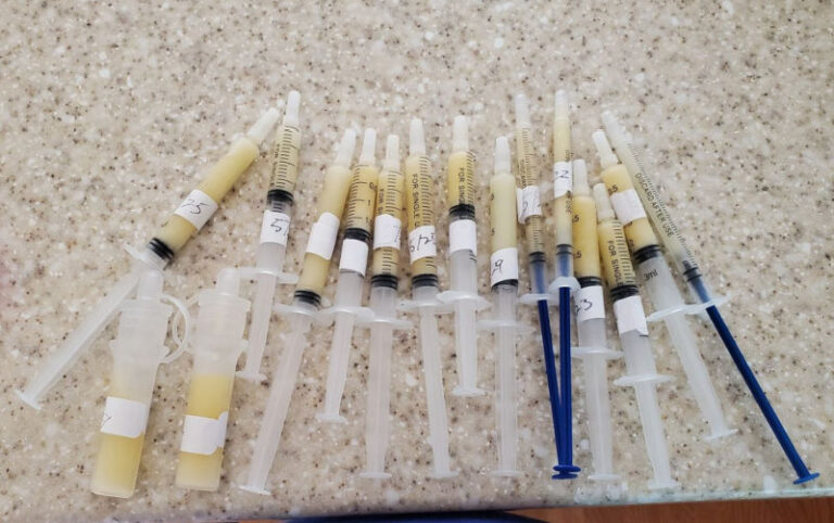 Harvesting Colostrum During Pregnancy - Exclusive Pumping