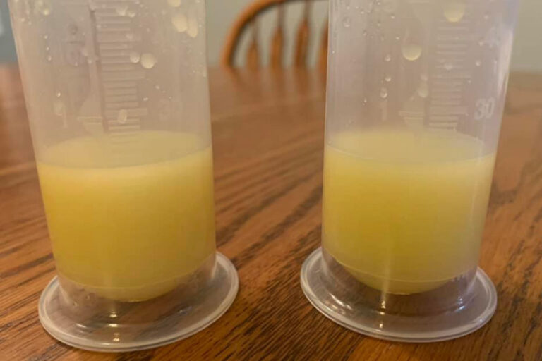 Harvesting Colostrum During Pregnancy - Exclusive Pumping